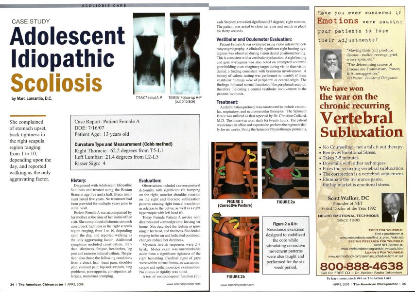 Adolescent Idiopathic Scoliosis | The American Chiropractor | April 2008